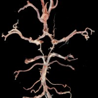 The Circle of Willis Guide – Interesting biomedical guide about the ...